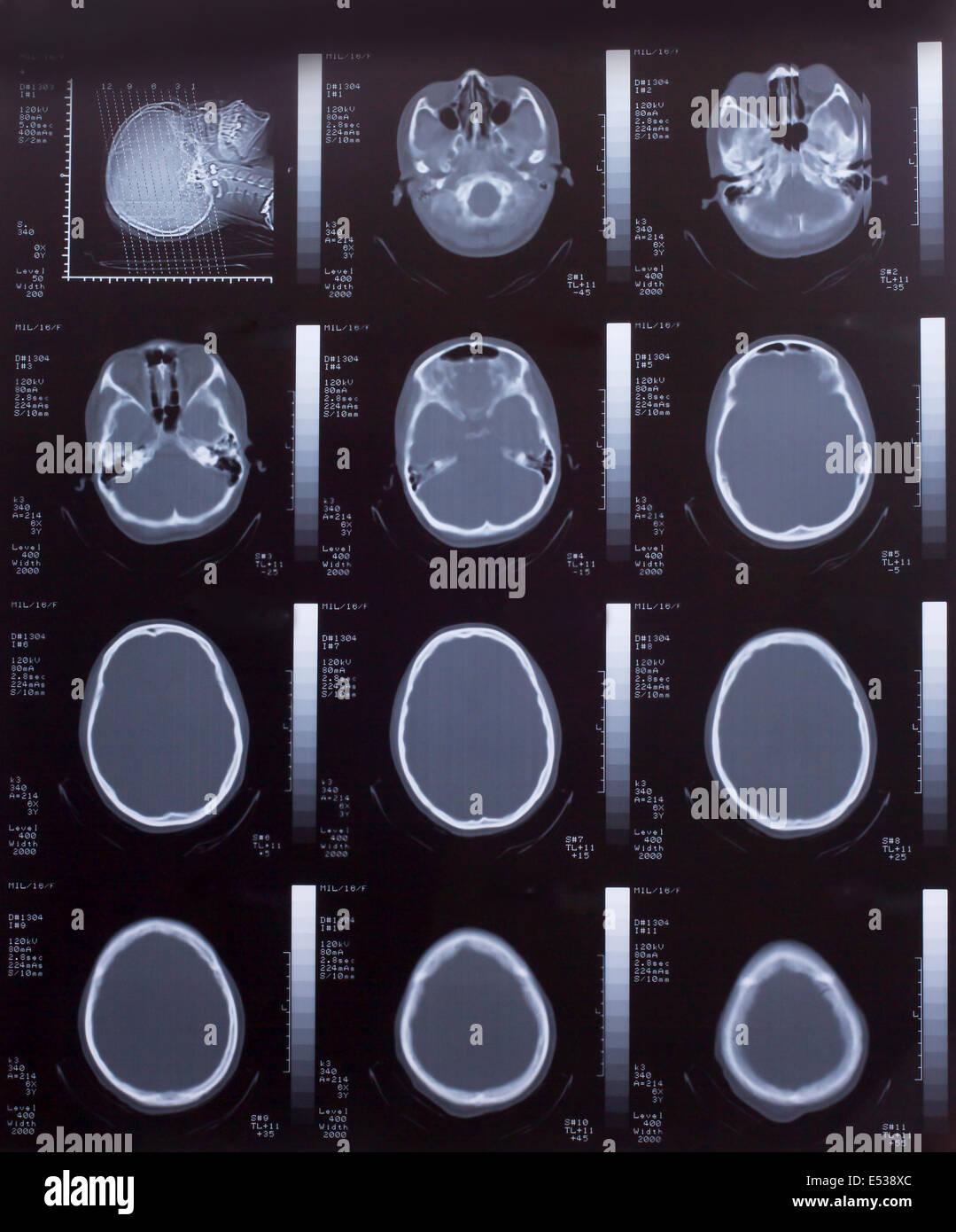 Photograph of the brain section hi-res stock photography and images - Alamy