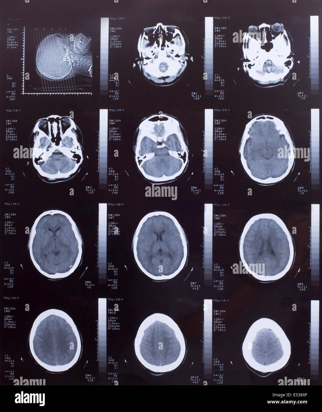 Photograph of the brain section hi-res stock photography and images - Alamy