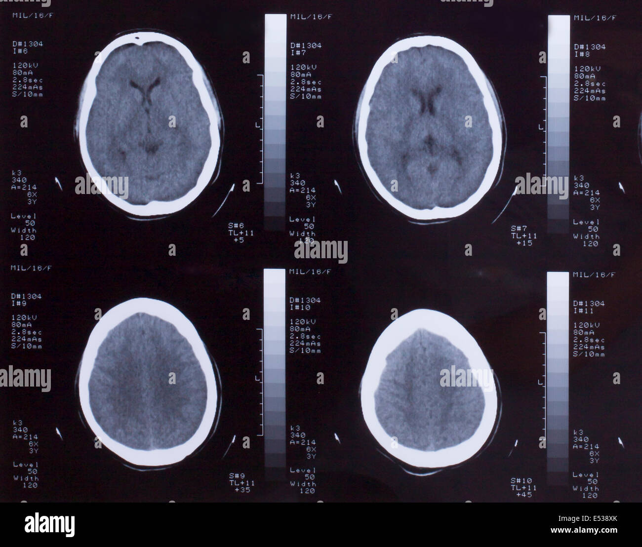 Cat brain anatomy hi-res stock photography and images - Alamy