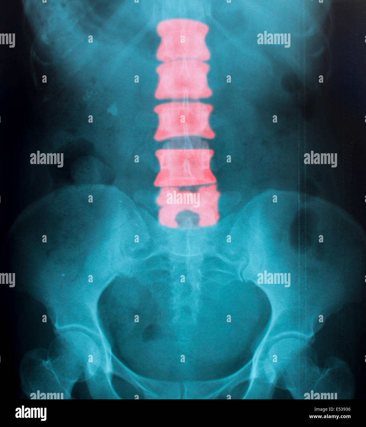 X-Ray Image Of Human for a medical diagnosis Stock Photo - Alamy
