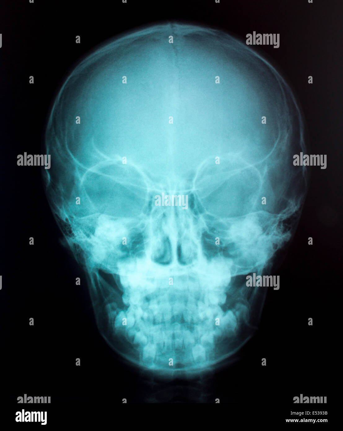 X-Ray Image Of Human for a medical diagnosis Stock Photo - Alamy