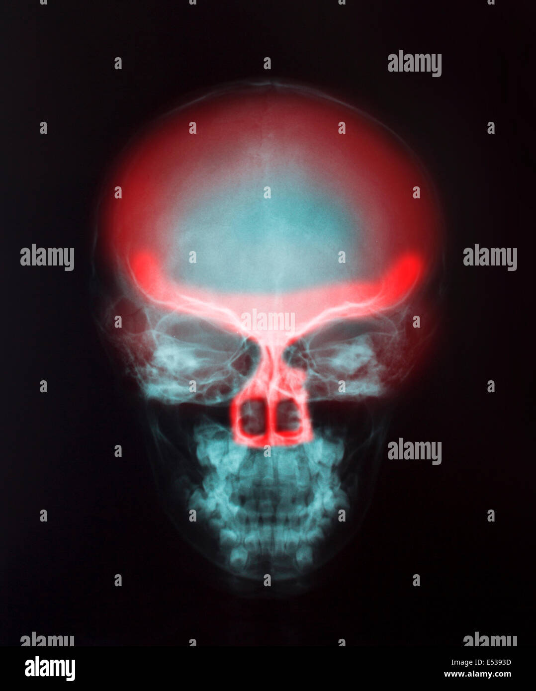 X-Ray Image Of Human for a medical diagnosis Stock Photo - Alamy