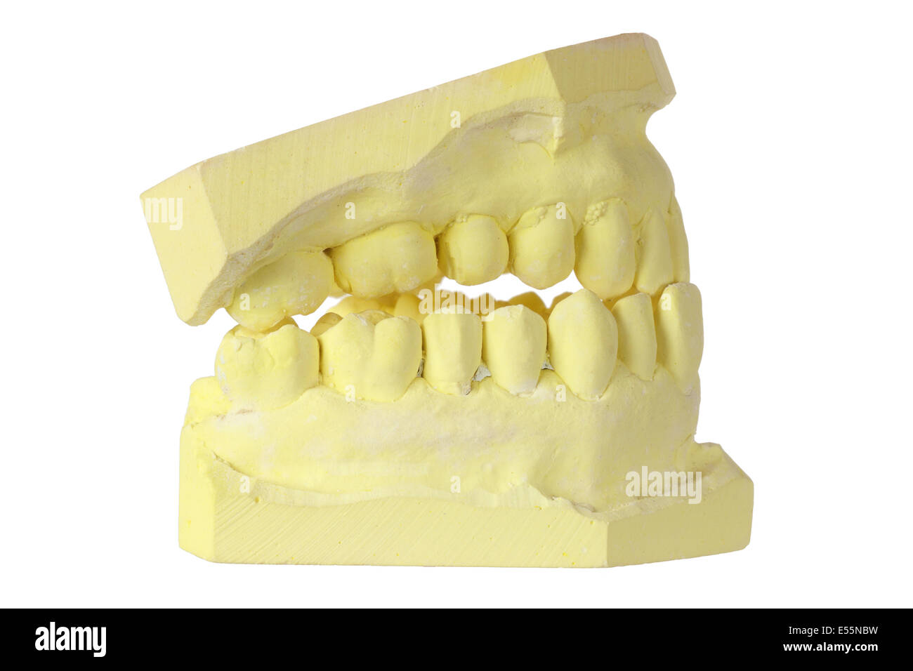 Denture mould hi-res stock photography and images - Alamy