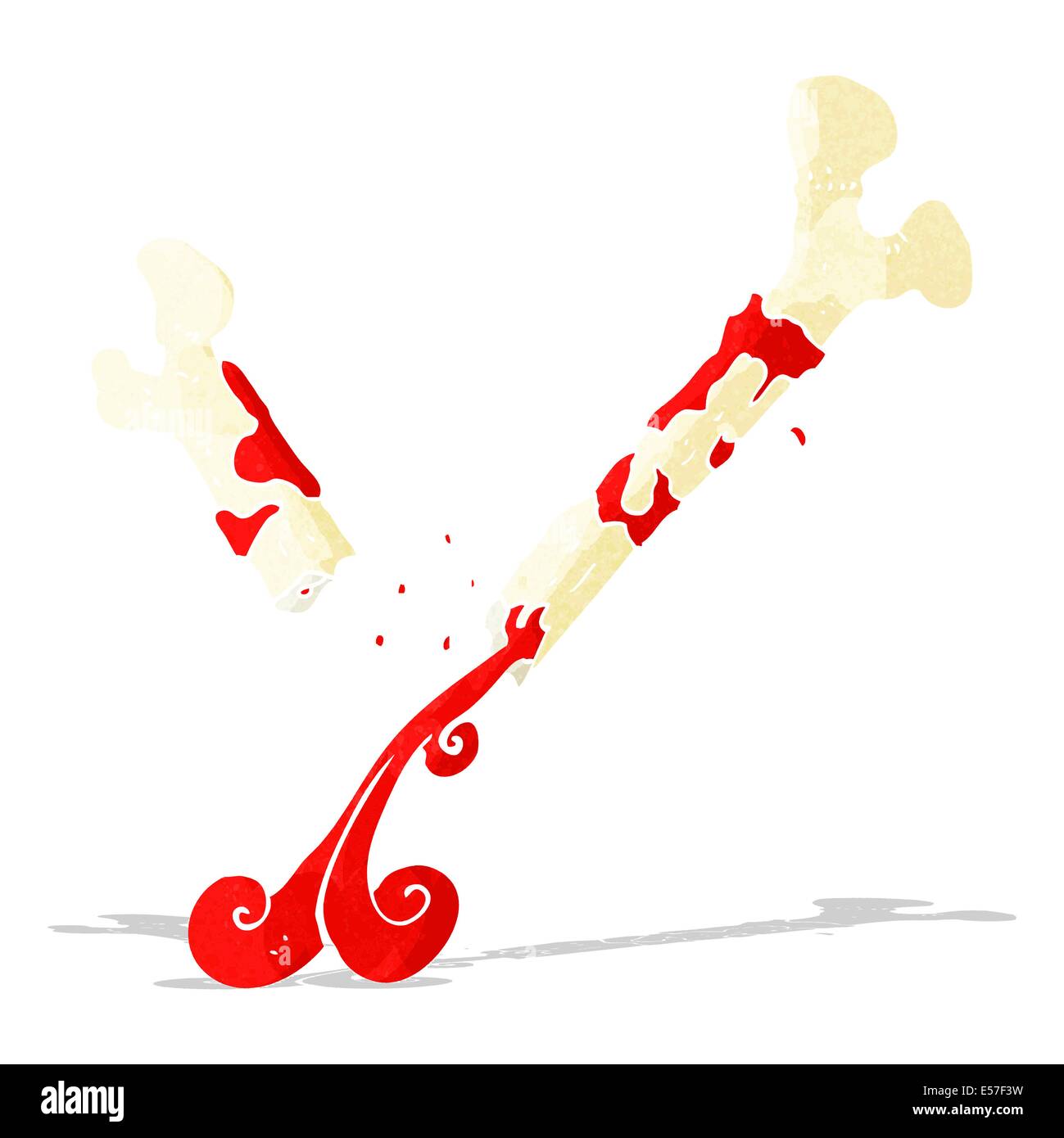 gross broken bone cartoon Stock Vector Image & Art - Alamy