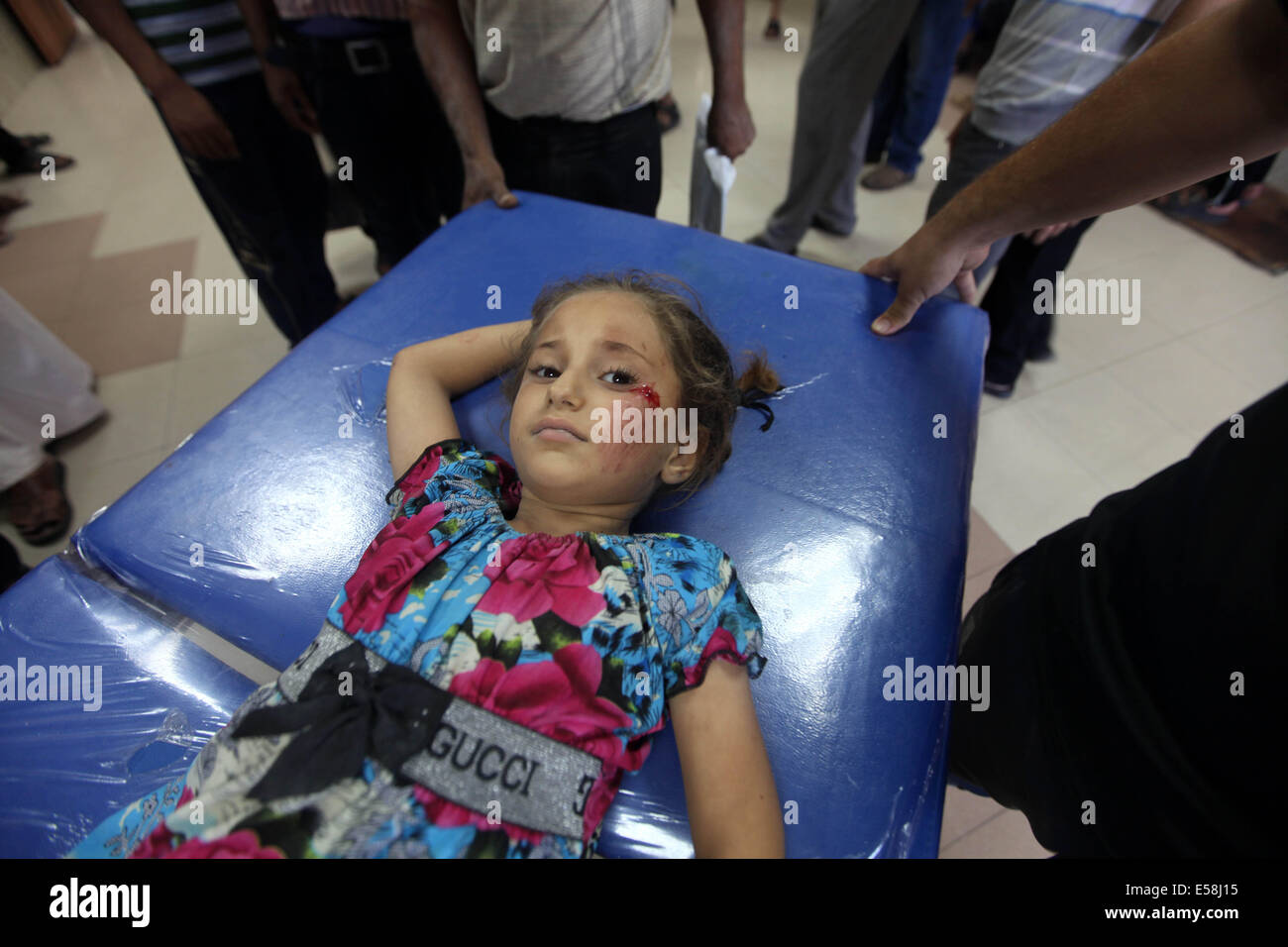 Gaza, Palestinian Territories. 22nd July, 2014. Injuries of children ...