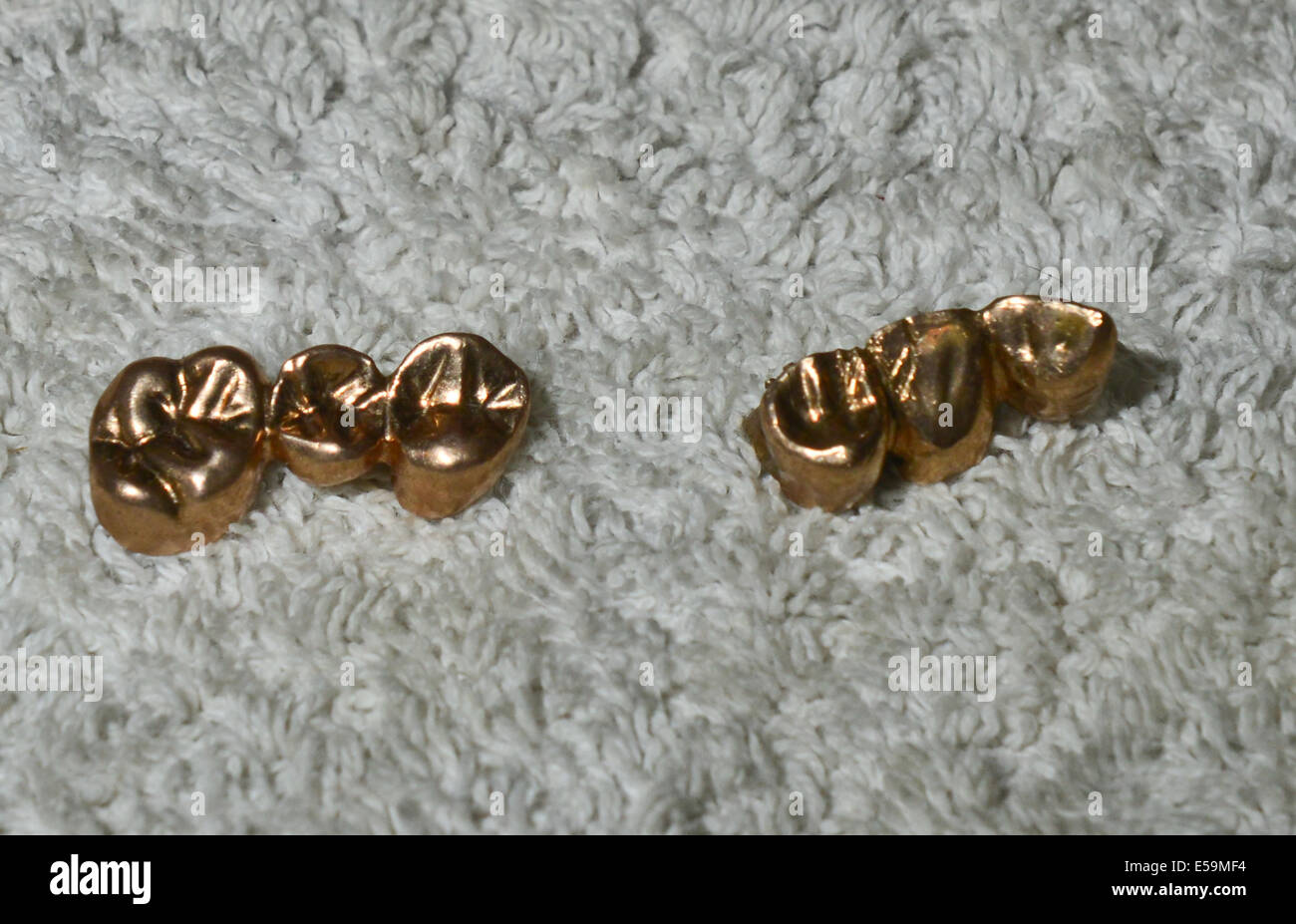 Gold Crown Tooth Holocaust