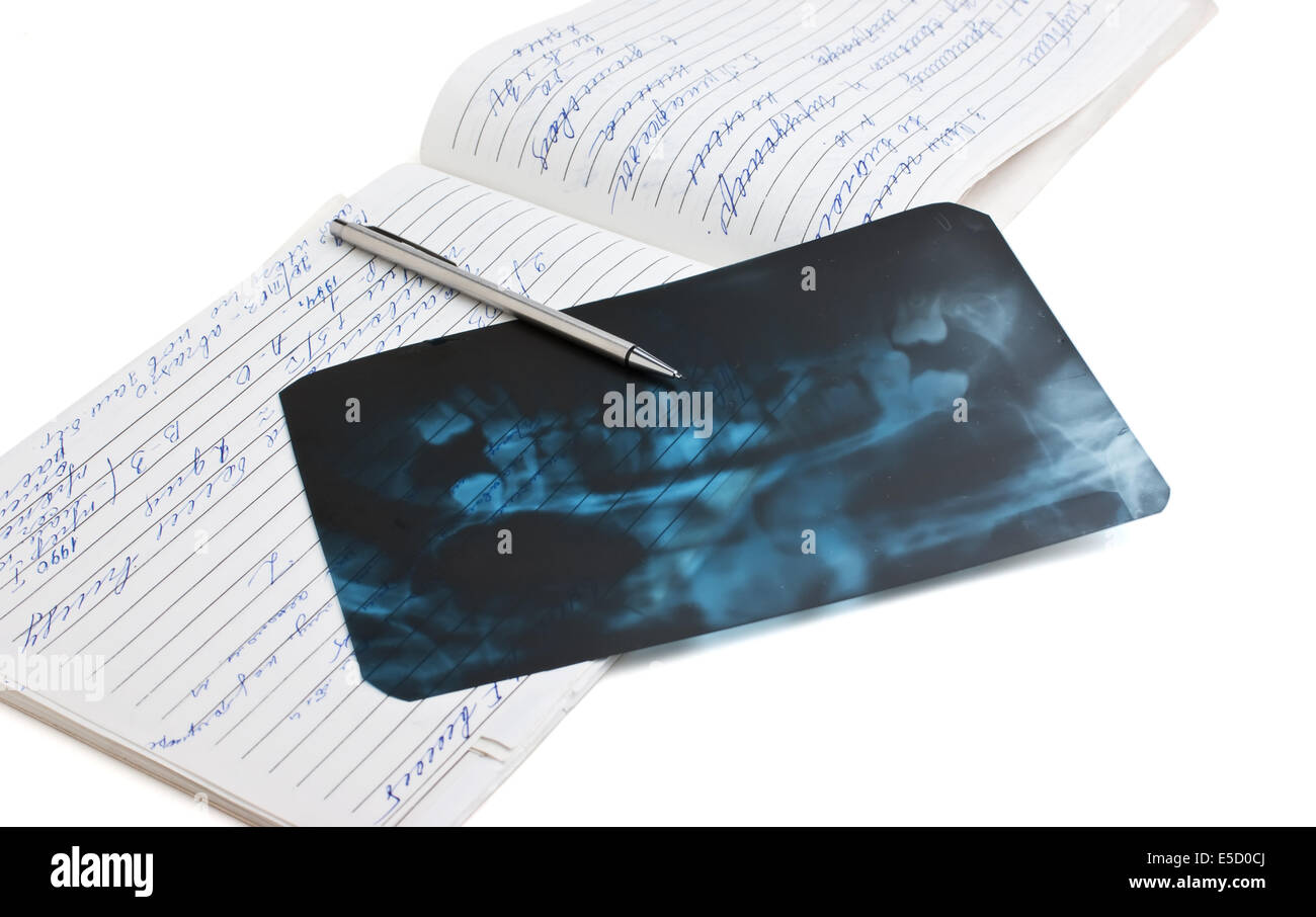 open medical history and x-ray isolated on a white background Stock ...