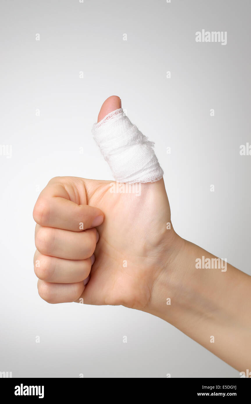 Broken Thumb High Resolution Stock Photography and Images - Alamy