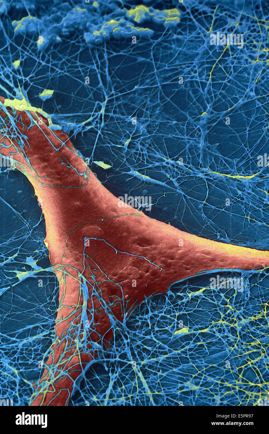 Fibroblast and Collagen fibres, SEM (Scanning Electron Microscope Stock ...