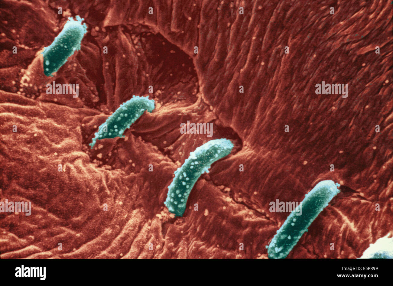 SEM (Scanning Electron Microscope) of stiches on the skin Stock Photo ...