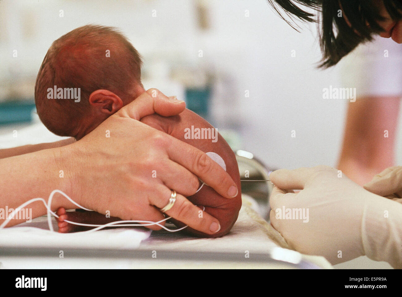Lumbar puncture performed on a premature new born baby Stock Photo - Alamy