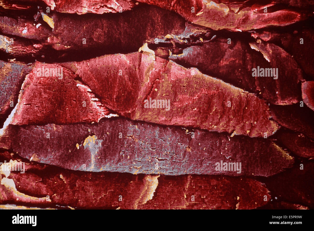 Scanning electron microscope cell hi-res stock photography and images ...