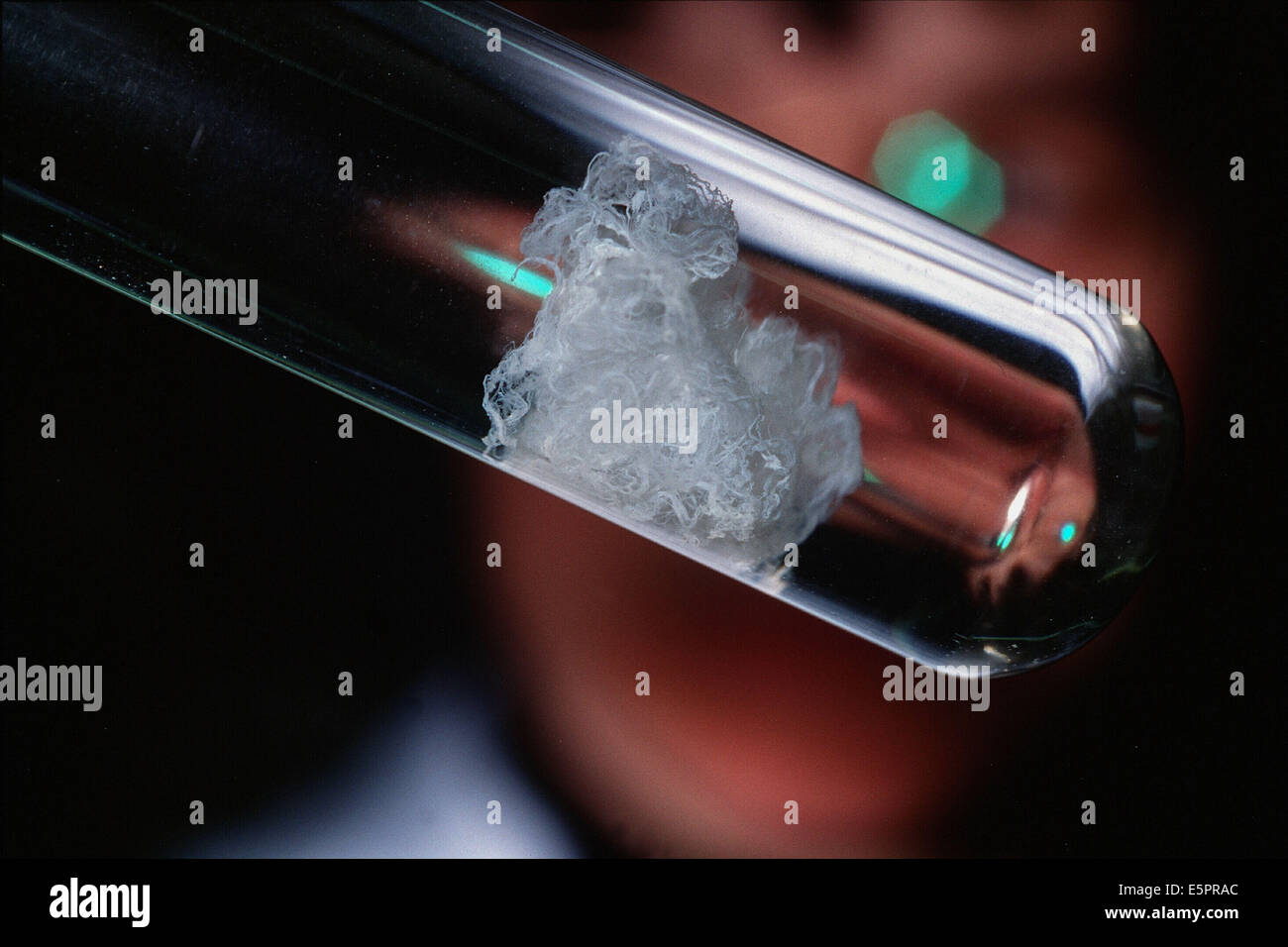 Genethon research laboratory, Evry, France. Solution of purified DNA ...