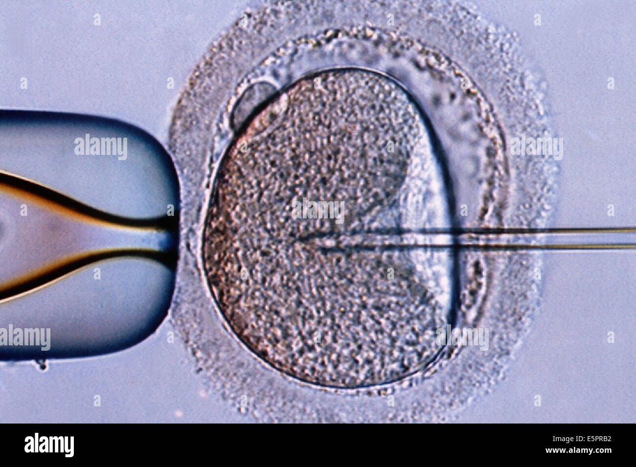 Intracytoplasmic sperm injection, Light microscope Stock Photo - Alamy
