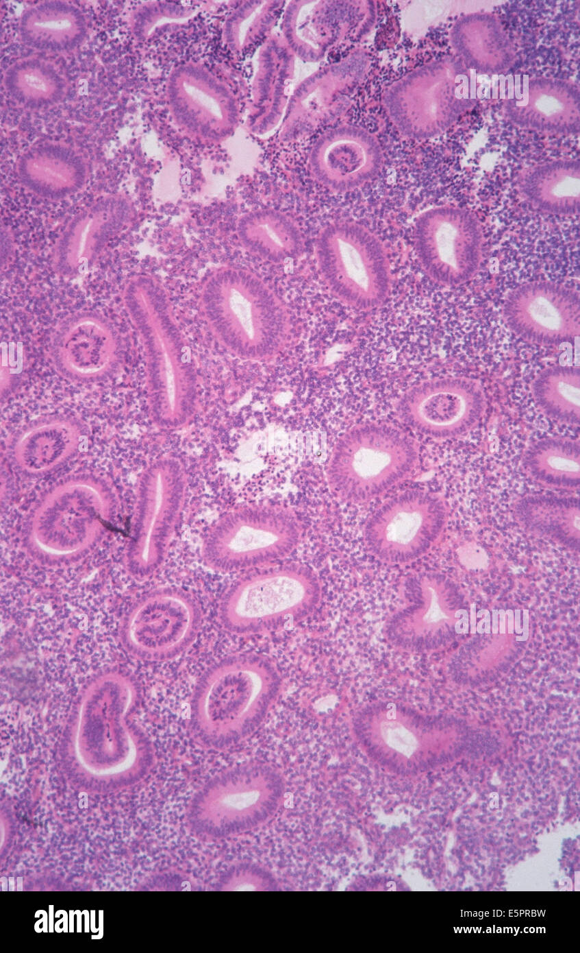 Normal uterus hi-res stock photography and images - Alamy