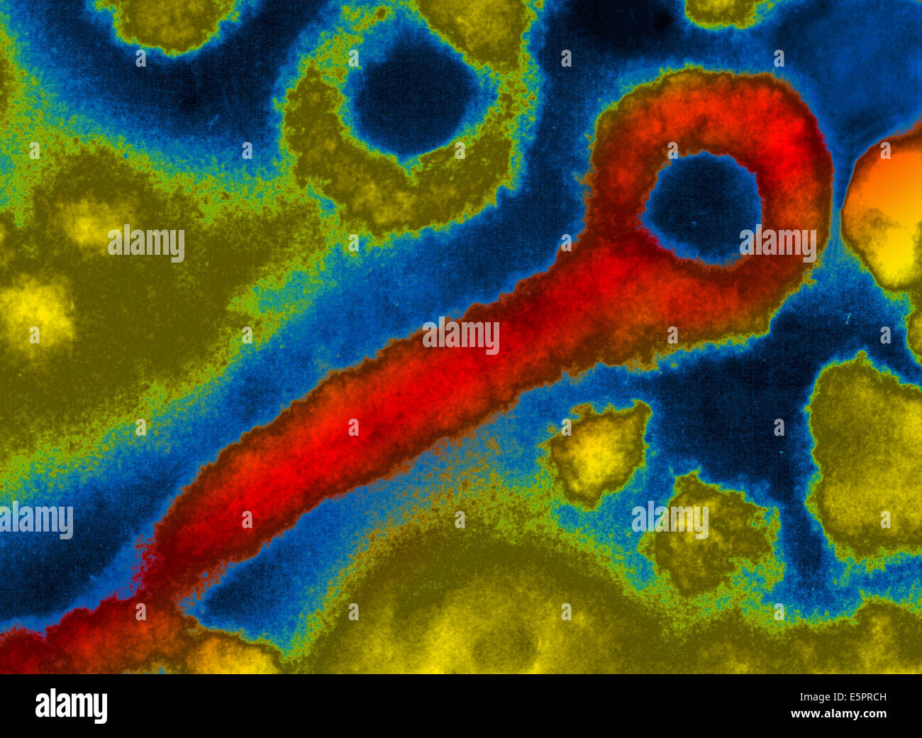 Color enhanced Transmission Electron Micrograph (TEM) of the ebola ...