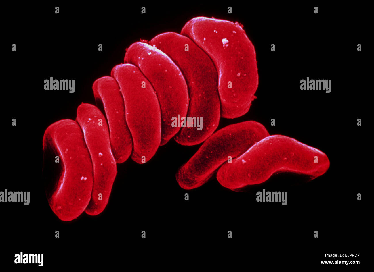 Red blood cell sem hi-res stock photography and images - Alamy