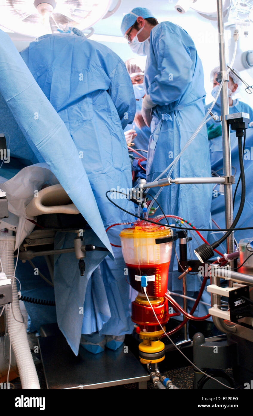 Heart surgery. Cardiopulmonary by-pass surgery Stock Photo - Alamy