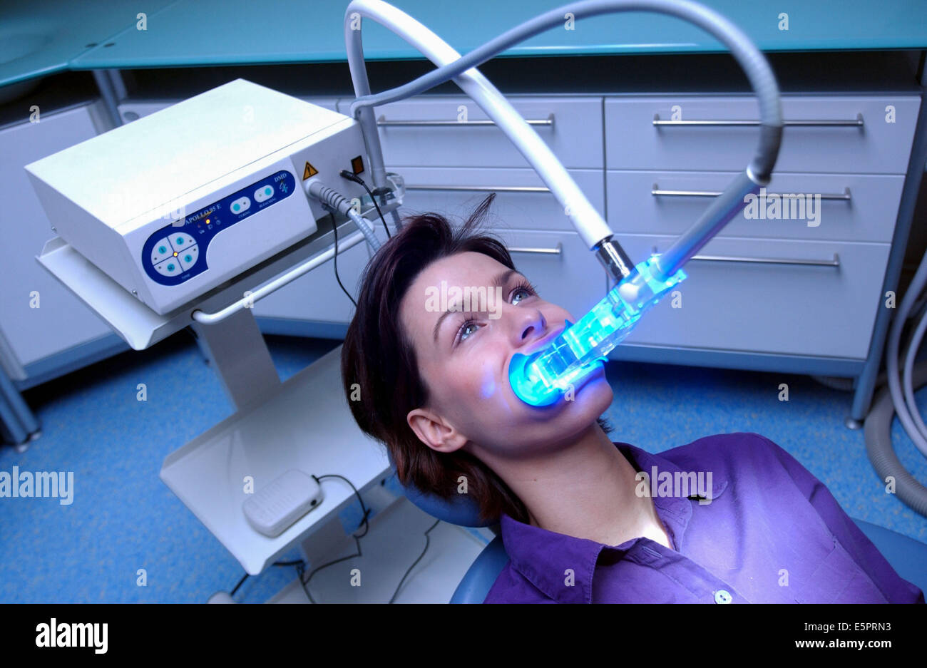 Application of a gel containing hydrogen peroxide (15%) during 20 to 90 ...