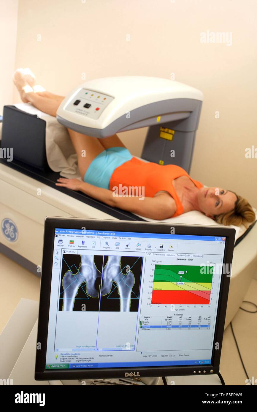 Densitometer Stock Photos & Densitometer Stock Images - Alamy