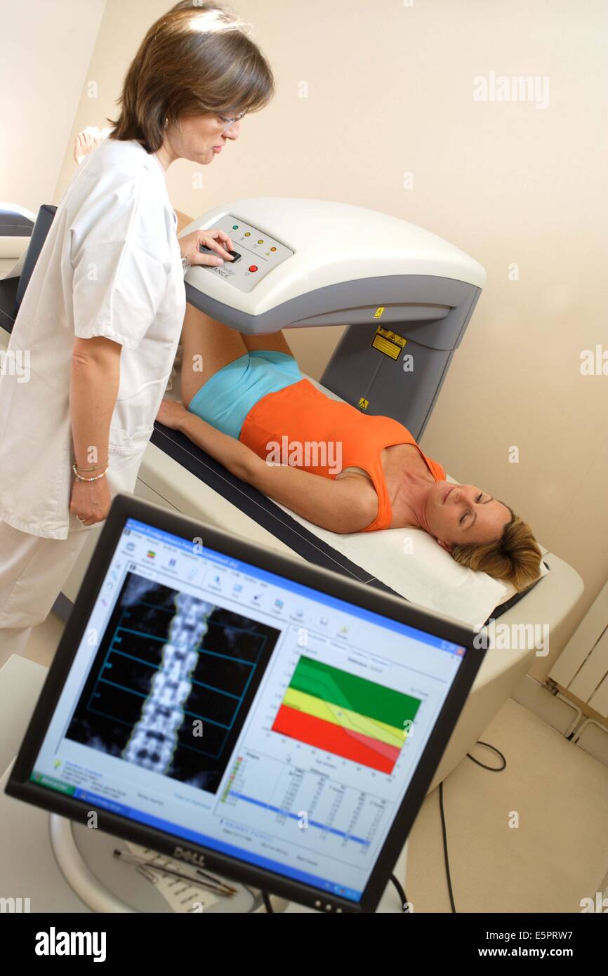 A doctor uses a bone densitometer to measure the optical density of the ...