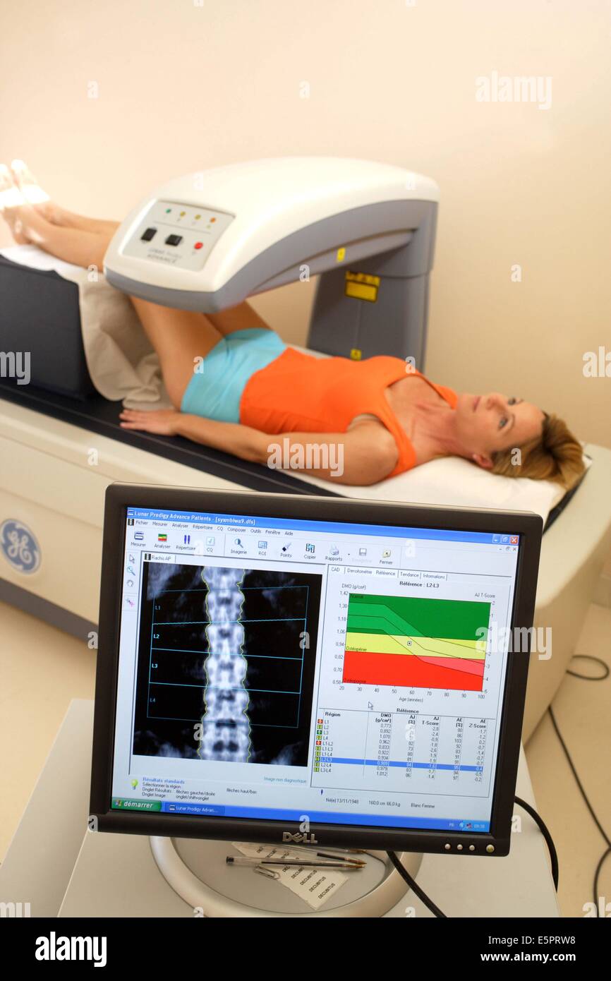 A doctor uses a bone densitometer to measure the optical density of the ...