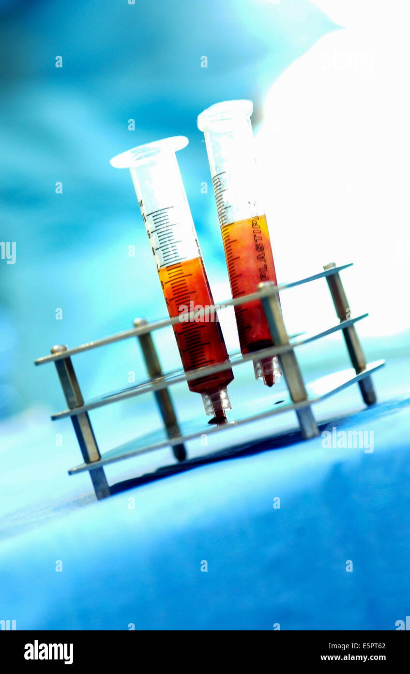 Esthetic surgery, Lipostructure or lipofilling Stock Photo - Alamy