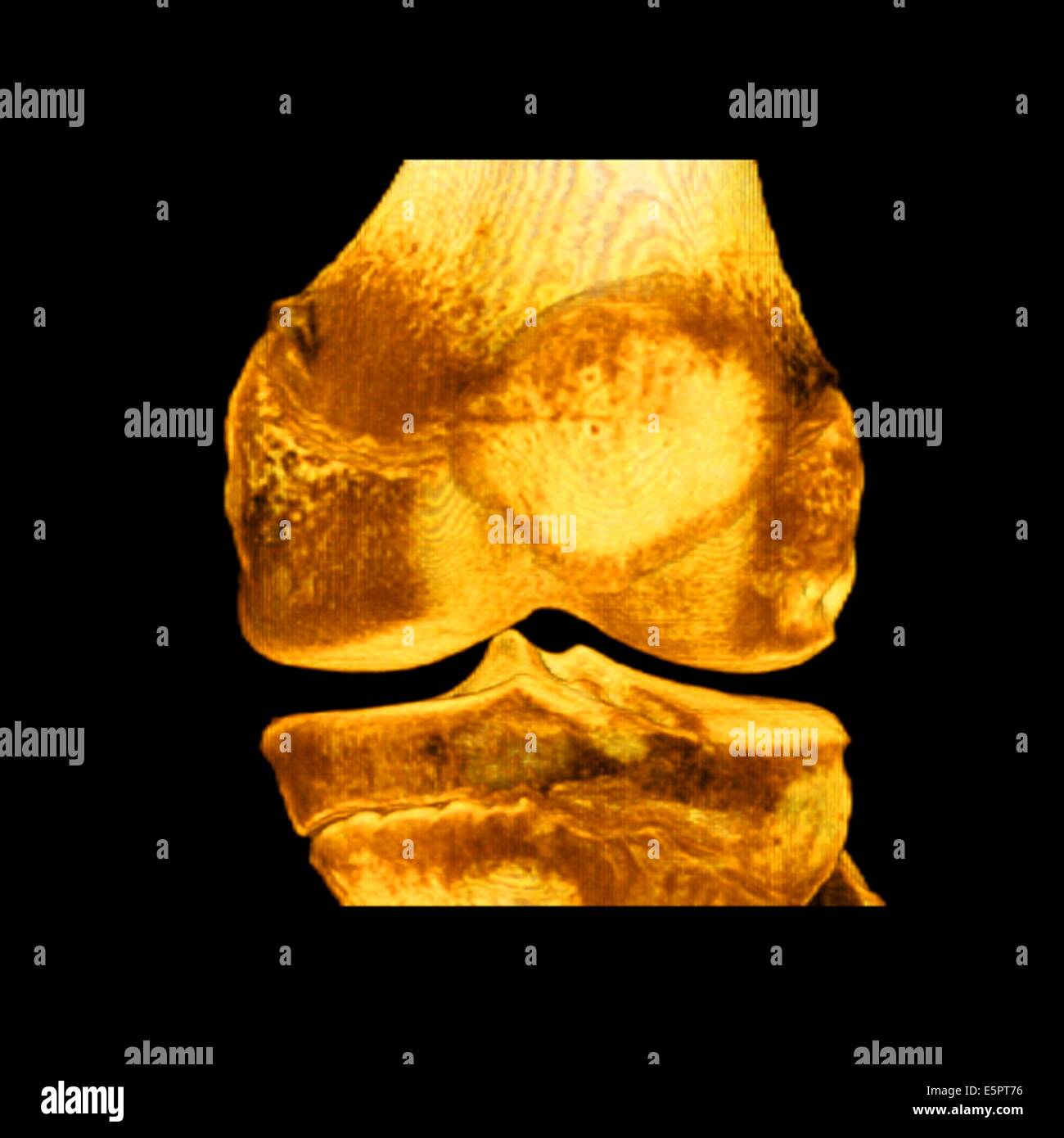 Tomographic reconstruction hi-res stock photography and images - Alamy