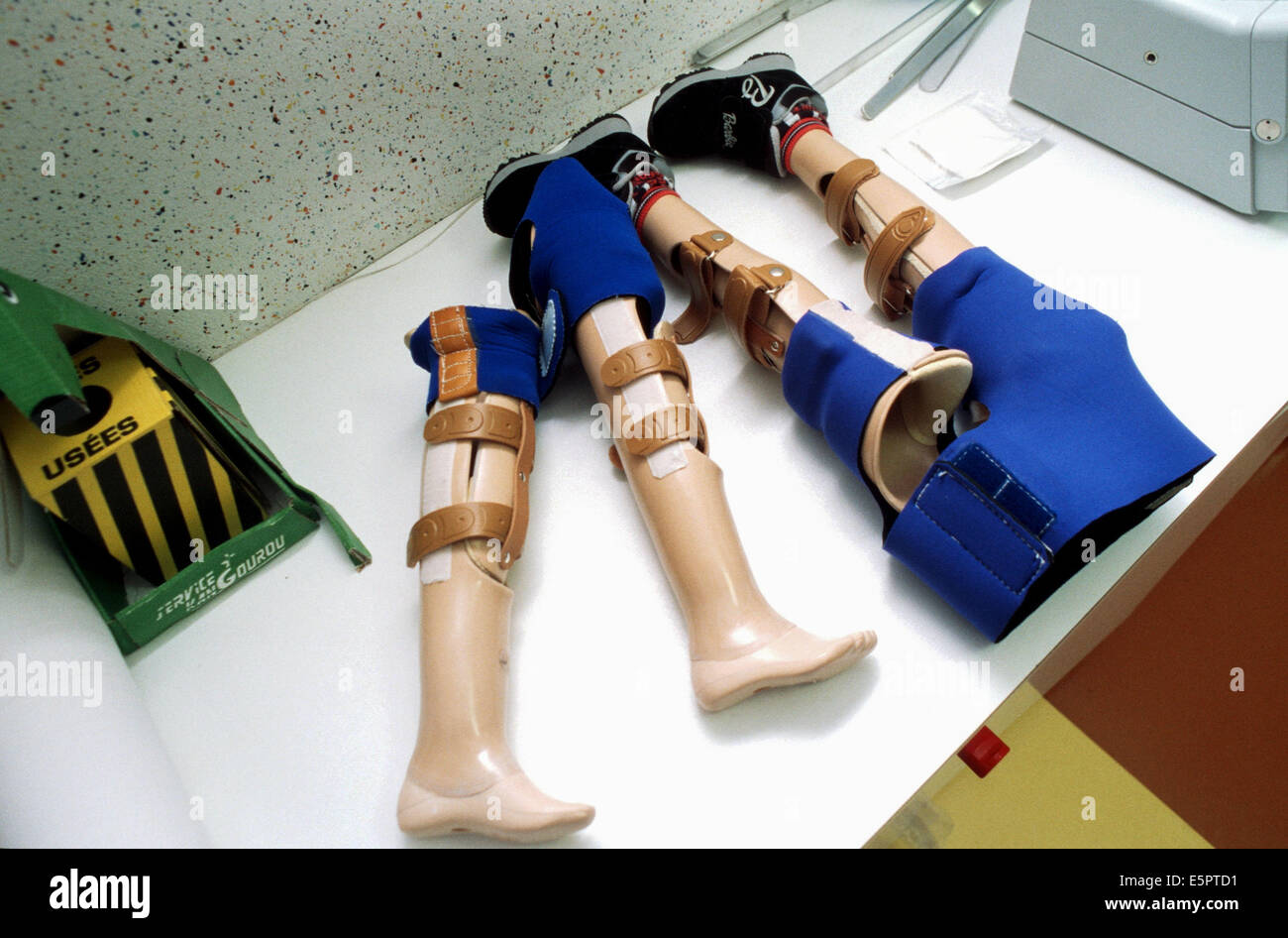 Prosthetic leg child hi-res stock photography and images - Alamy