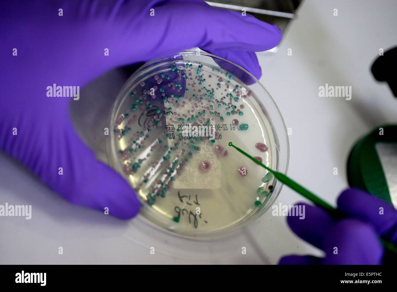 Culture of pathogenic fungi on chromogenous substrat, The color of this ...