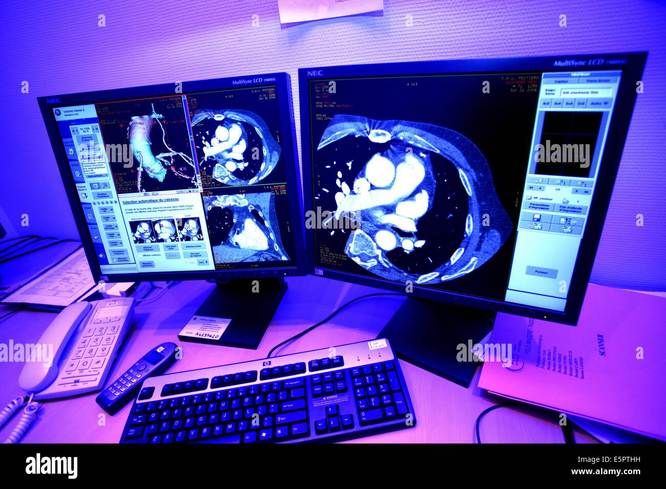 The 64-Slice CT Scanner produces 64 slices per rotation, This advanced ...