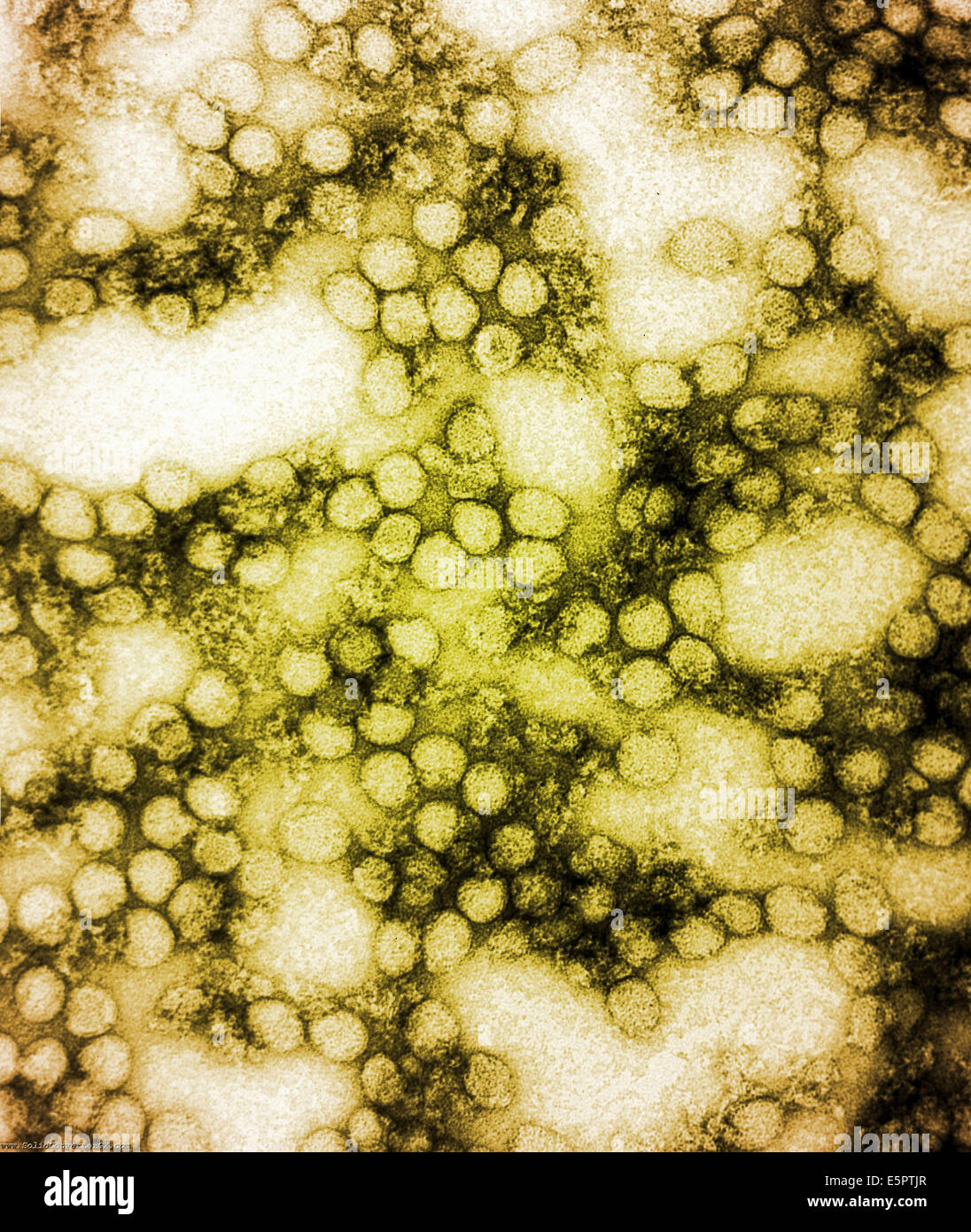 Transmission electron micrograph (TEM) of yellow fever viruses ...