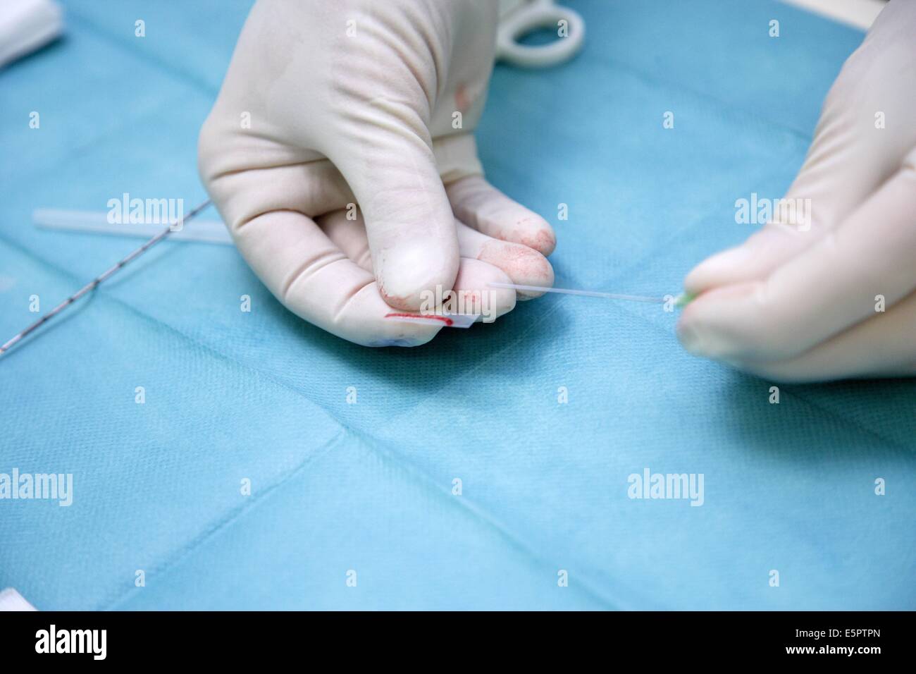 Biopsy of peripheral lymph nodes assisted by medical imaging for ...