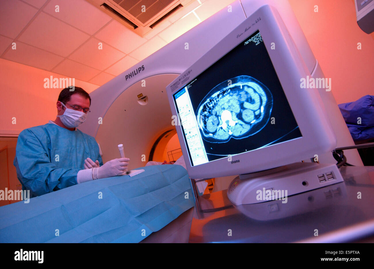 Patient undergoing a liver biopsy assisted by Computed Tomography (CT ...