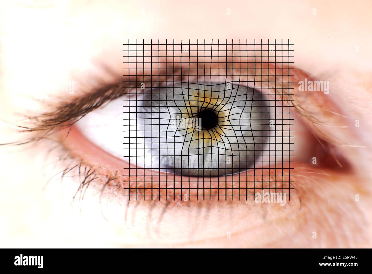 Amsler grid hi-res stock photography and images - Alamy