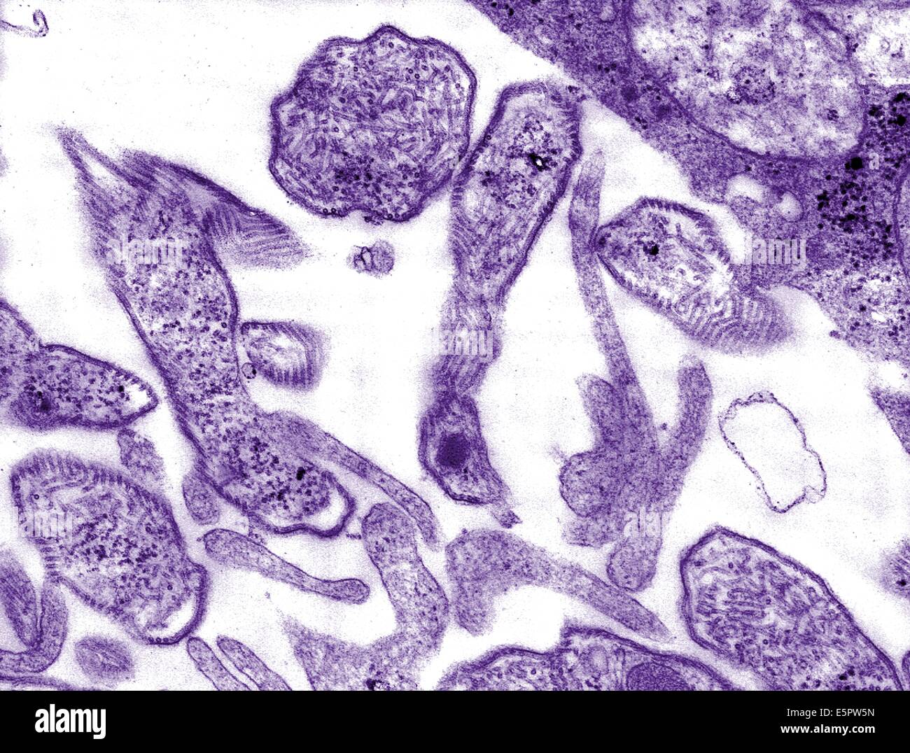Transmission electron micrograph (TEM) of the mumps viruses, This RNA ...