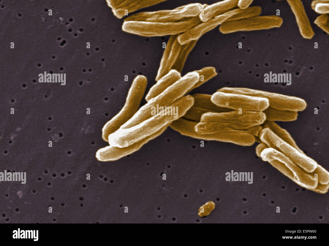 Scanning electron micrograph (SEM) of Gram-positive Mycobacterium tuberculosis bacilli, the ...