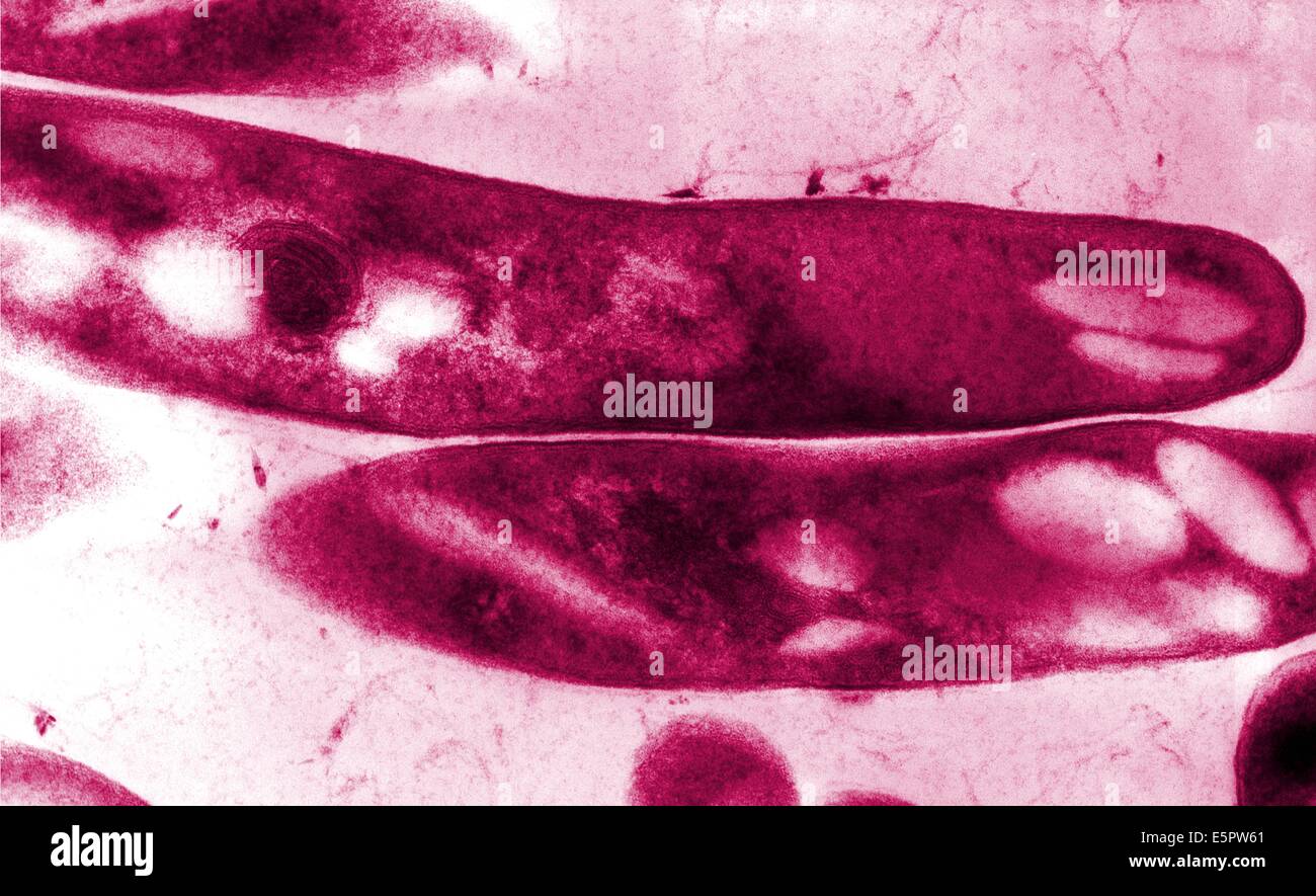 Mycobacterium Tuberculosis Gram Stain Isolation And Identification Of