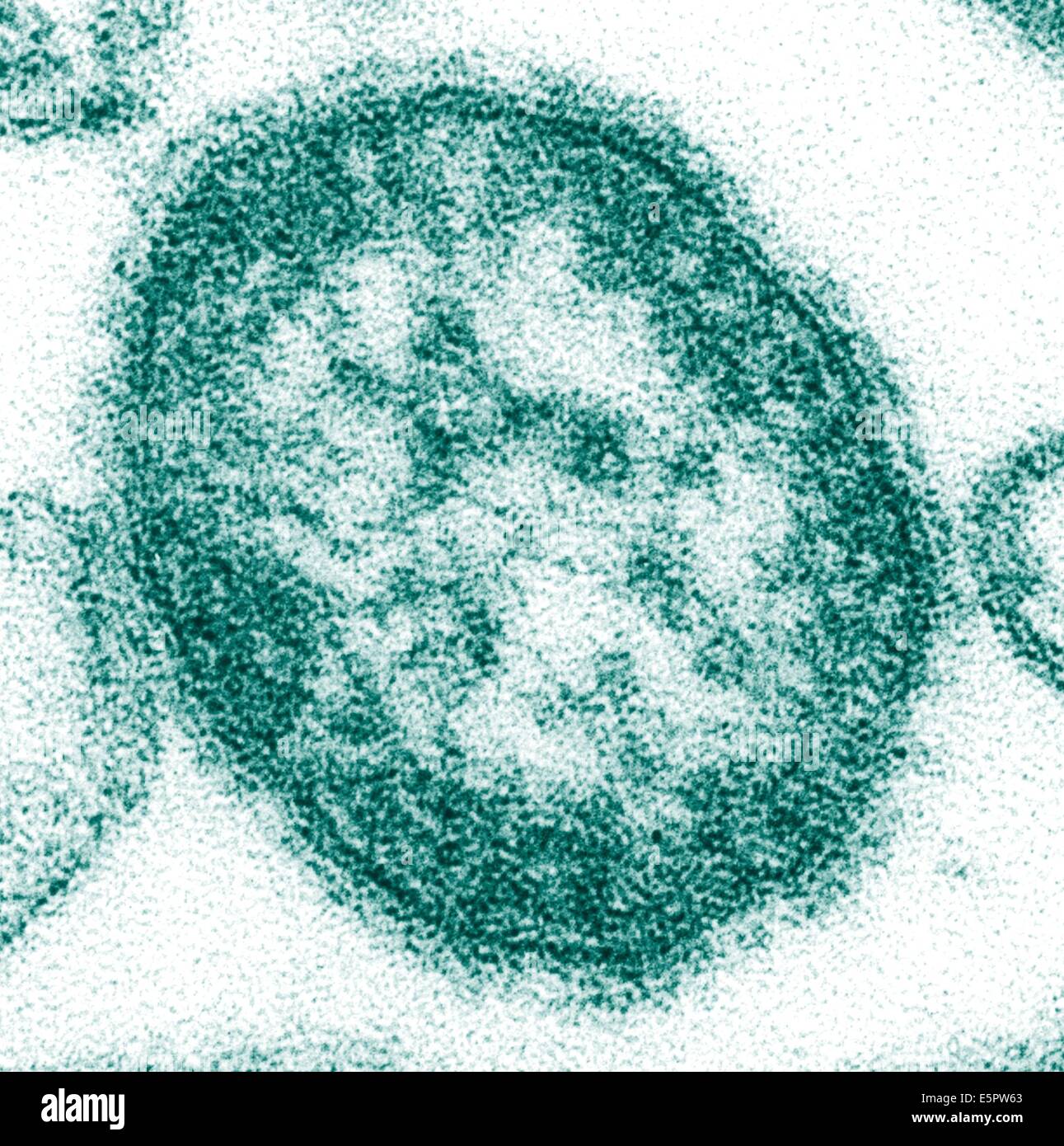 Transmission electron micrograph (TEM) of measles virus, This RNA virus ...