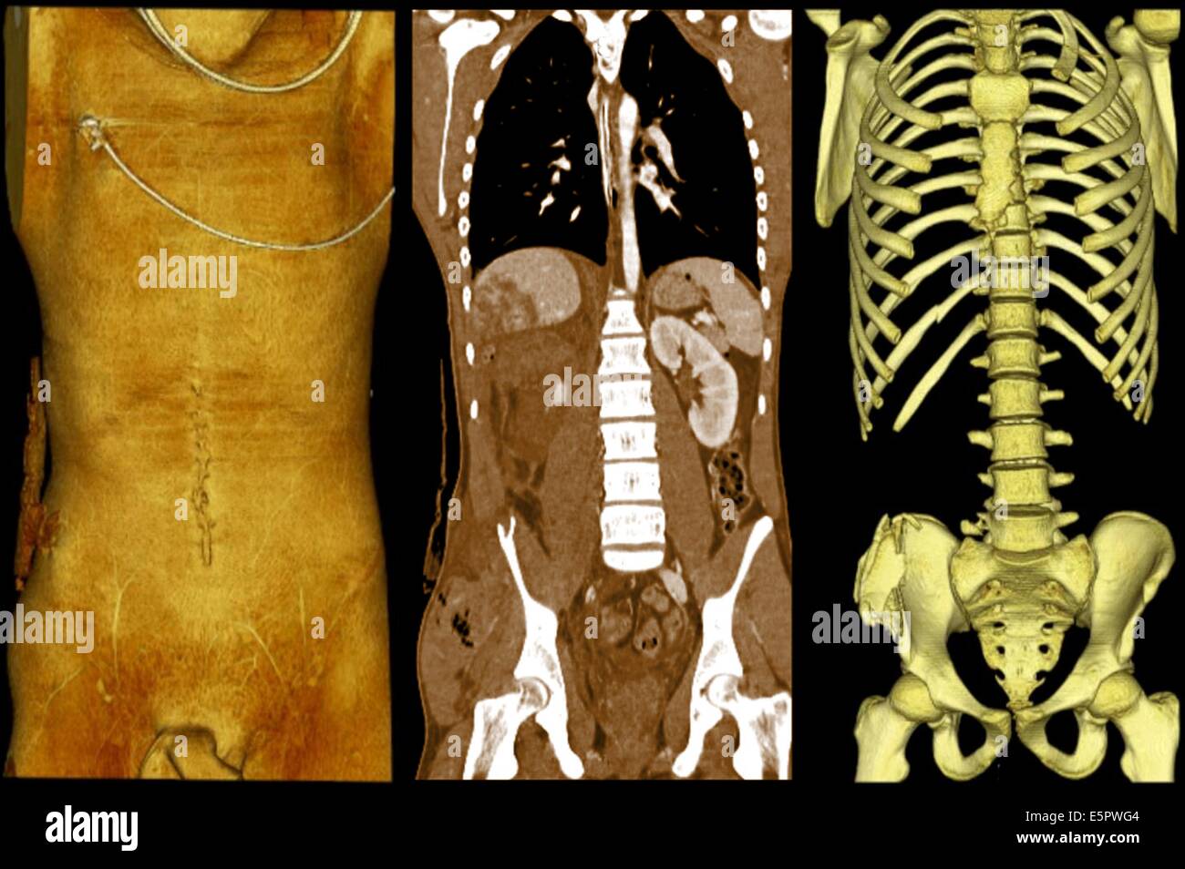 Ct Scan With 3d Reconstruction Ct Scan With 3d Reconstruction