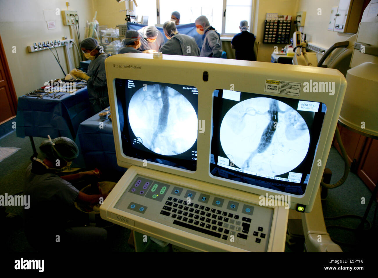 Aortic stent hi-res stock photography and images - Alamy