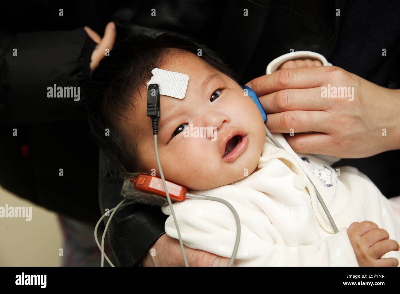 Baby undergoing deafness screening test with the method of the auditory ...
