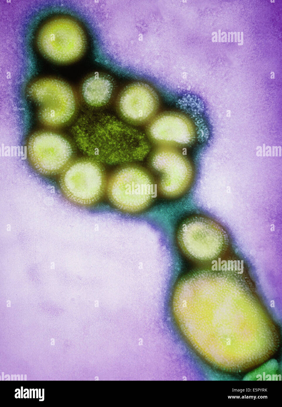 Colored transmission electron micrograph (TEM) of Hong Kong influenza ...