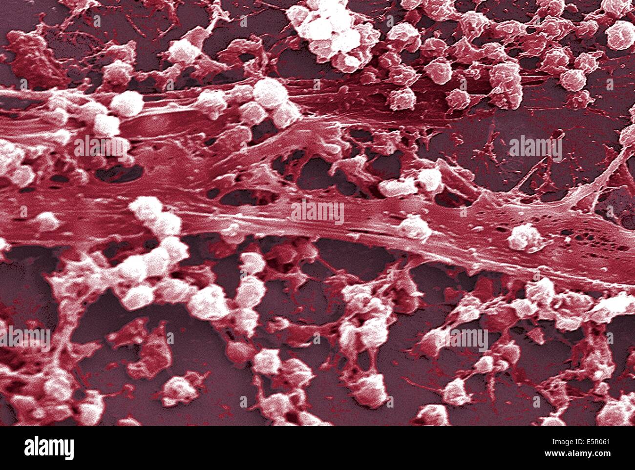 Tem bacteria hi-res stock photography and images - Alamy