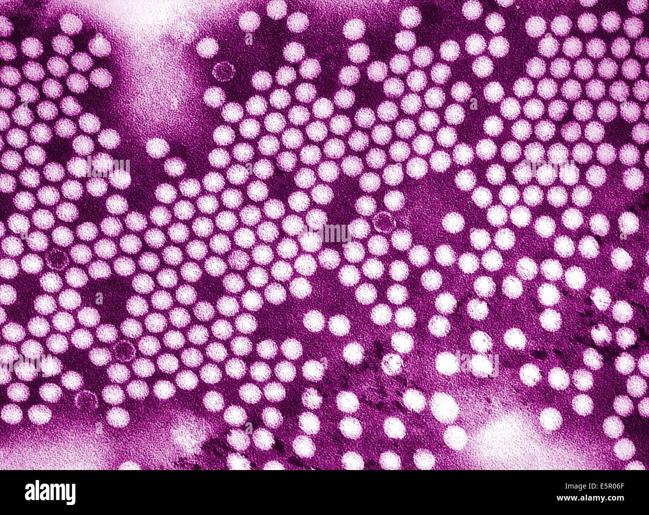 Transmission Electron Micrograph (TEM) of poliovirus, an RNA ...