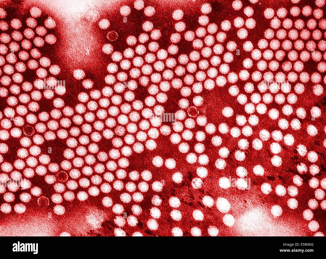Transmission Electron Micrograph (TEM) of poliovirus, an RNA ...