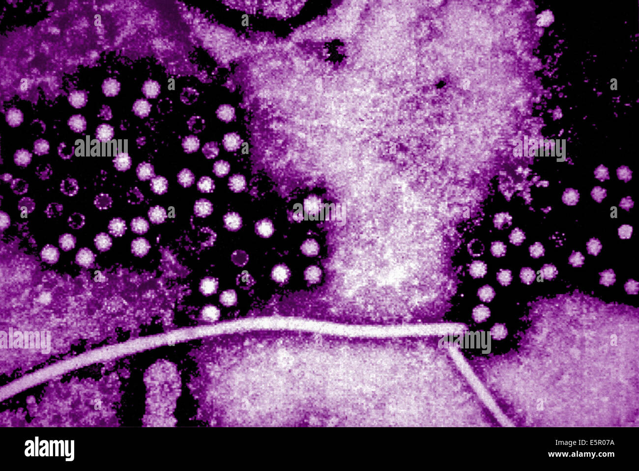 Electron micrograph of Hepatitis E viruses (HEV Stock Photo - Alamy
