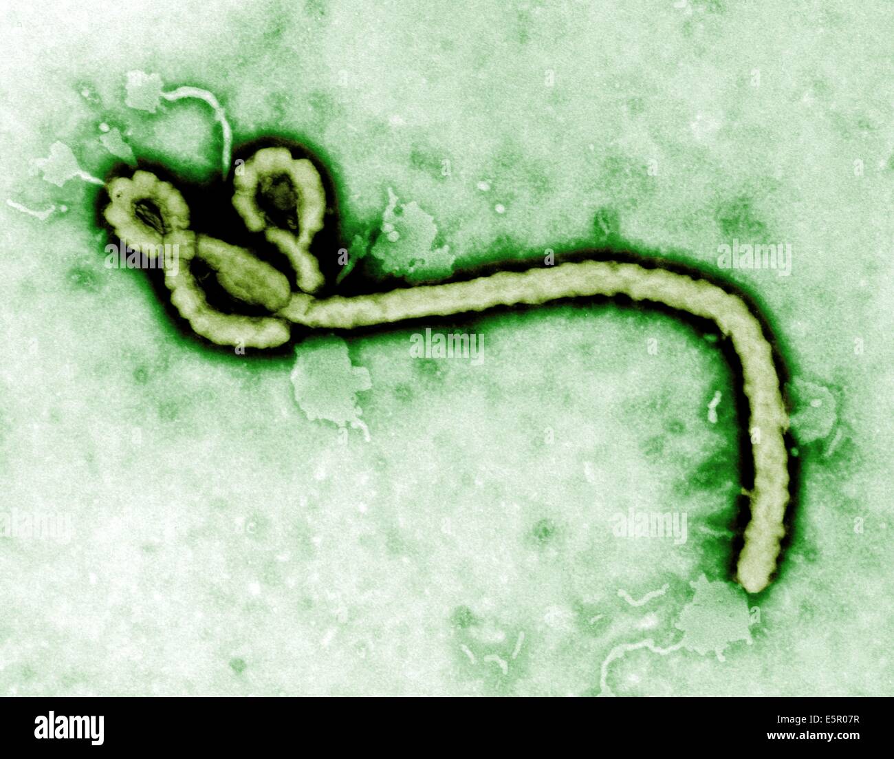 Color enhanced Transmission Electron Micrograph (TEM) of the ebola ...