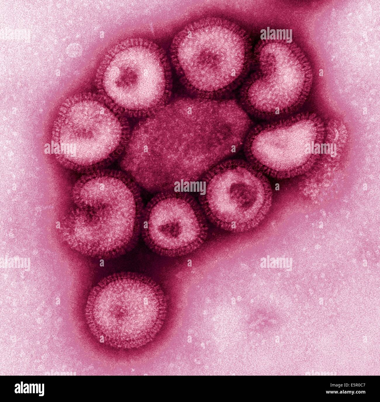 Transmission Electron Micrograph (TEM) of influenza virus particles ...