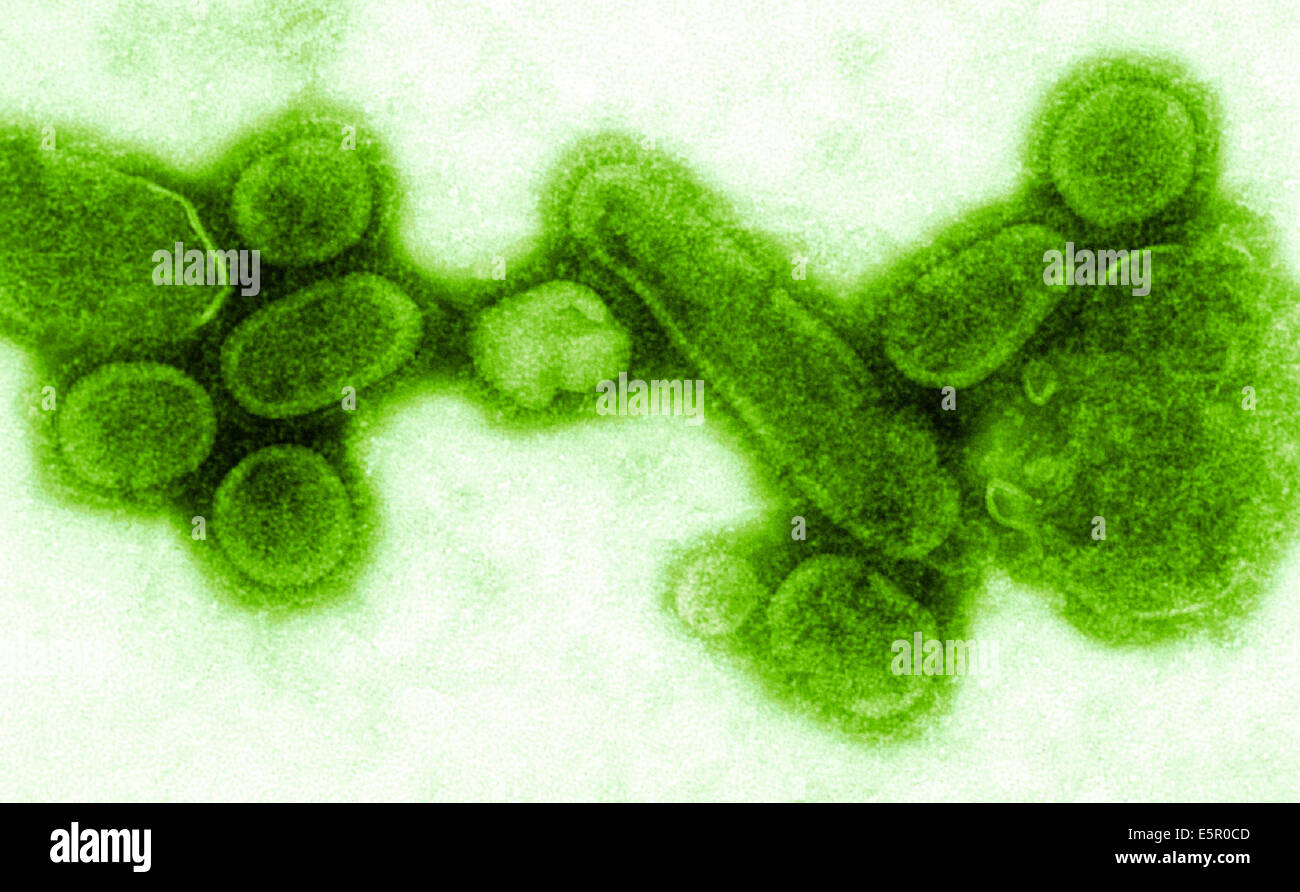Transmission Electron Micrograph (TEM) of Spanish flu virus, This ...